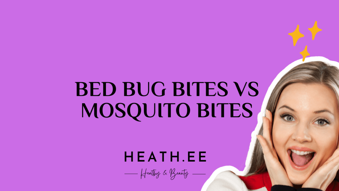 Bed Bug Bites vs Mosquito Bites: A Comprehensive Guide - Heathe