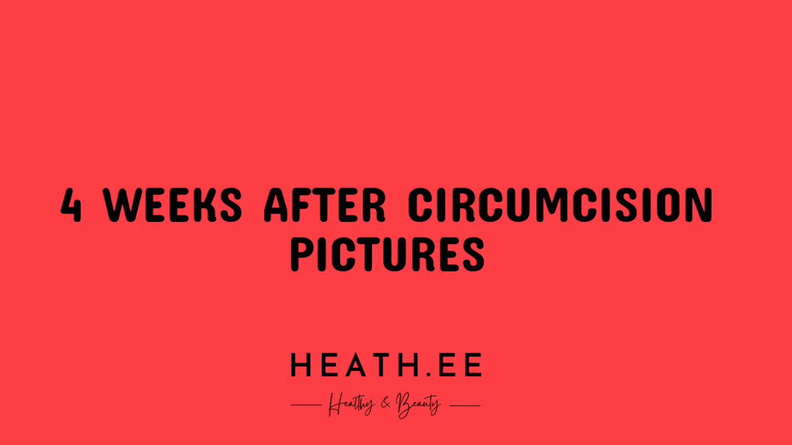 4 Weeks After Circumcision Pictures: What to Expect - Heathe